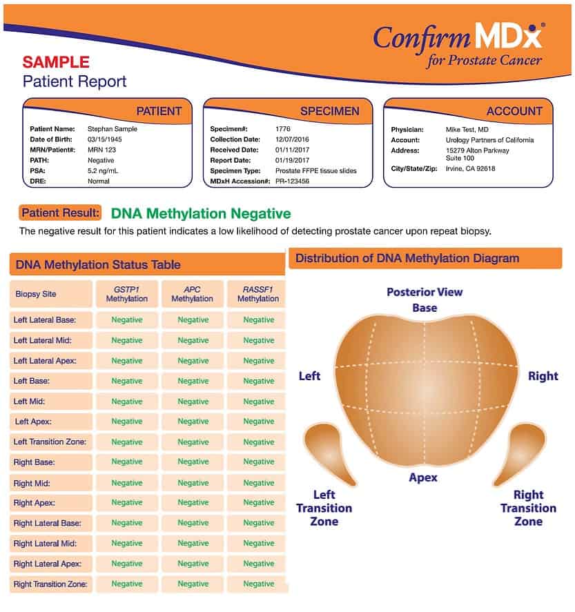 Confirm MDx Results - PC Markers