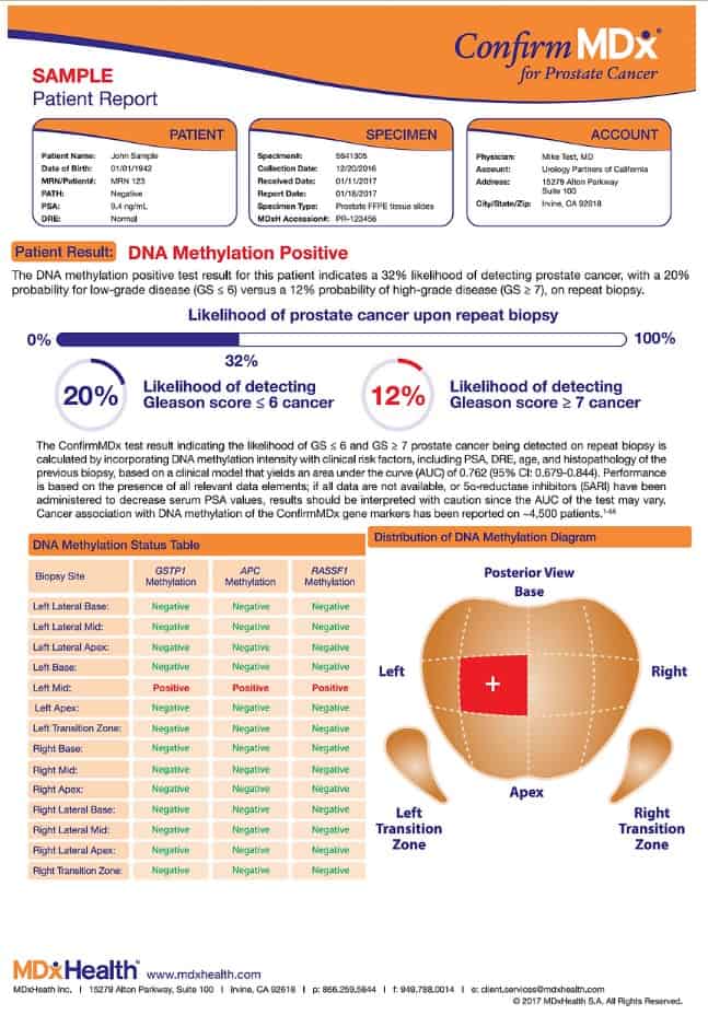 Confirm MDx Results - PC Markers
