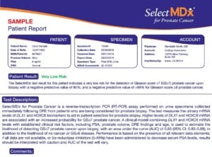 Select MDx test for prostate - PC Markers